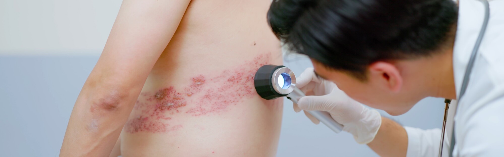 Graft Surgery - Skin Cancer Centre